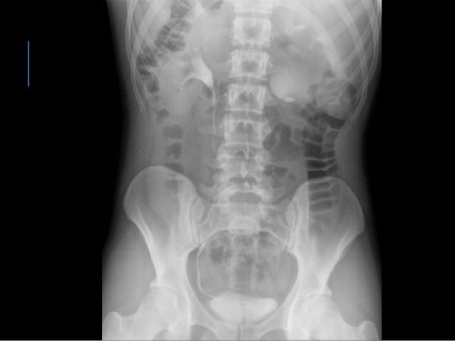 Estudios radiologicos de las vias urinarias