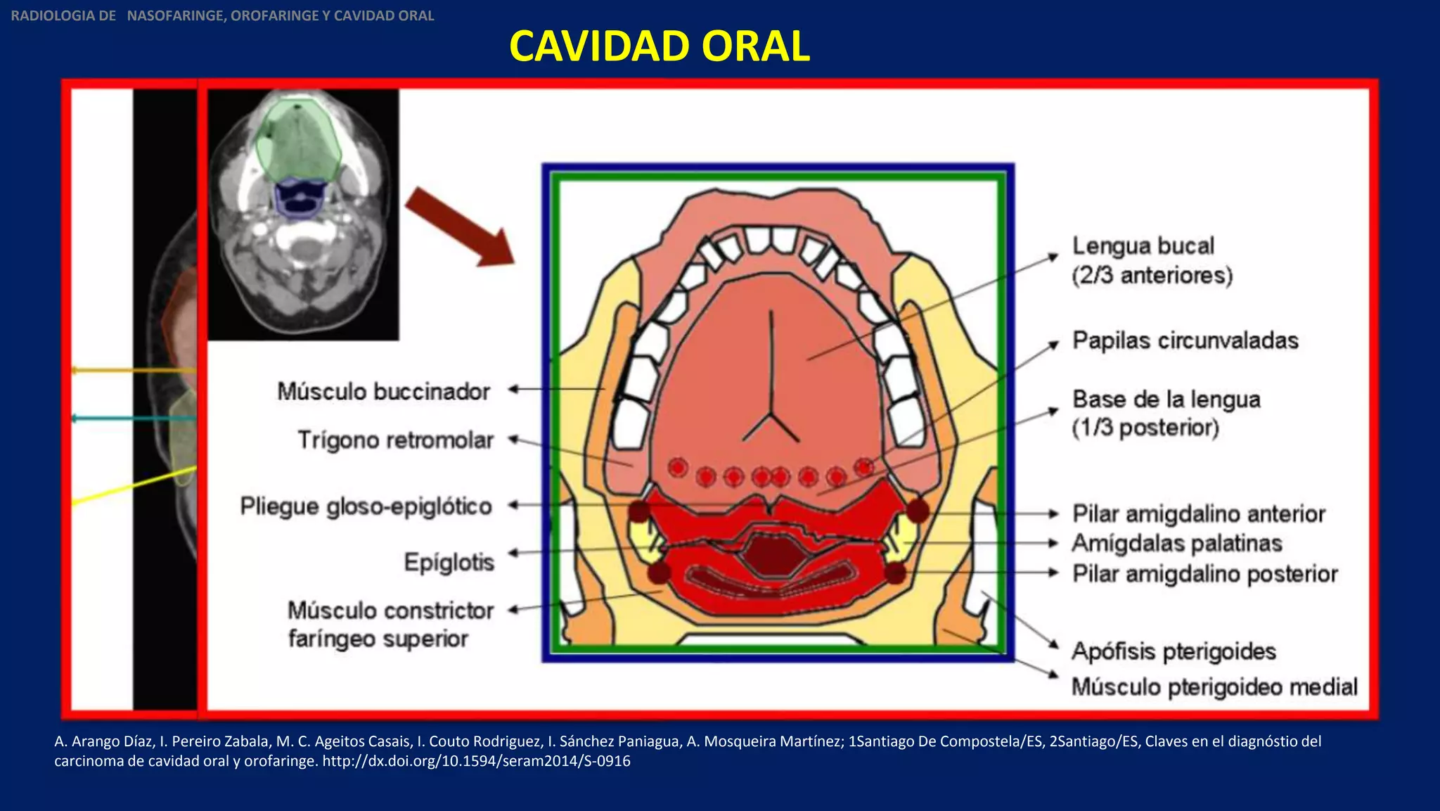 RADIOLOGIA DE NASOFARINGE^J OROFARINGE Y CAVIDAD ORAL.pptx