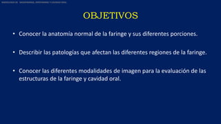 RADIOLOGIA DE NASOFARINGE^J OROFARINGE Y CAVIDAD ORAL.pptx
