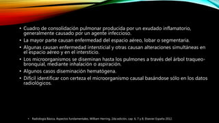 Radiologia, derrame pleural, neumonia y neumomediastino, Dr. Carlos A ...
