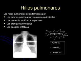 Radiologia de torax | PPT