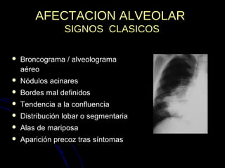Radiologia de torax | PPT