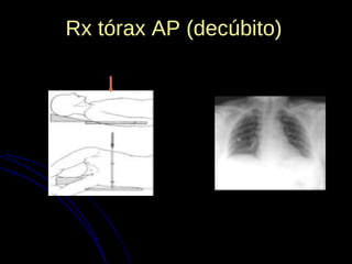 Radiologia de torax | PPT