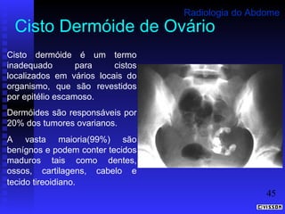 Radiologia do abdome | PPS