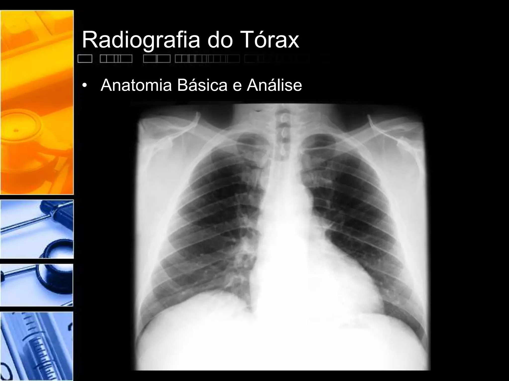 Radiologia do tórax | PPTX