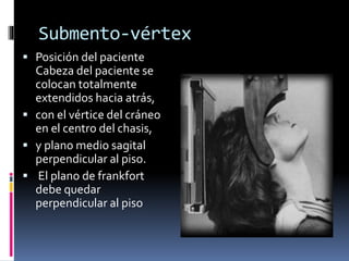 Radiologia extrabucal | PPTX