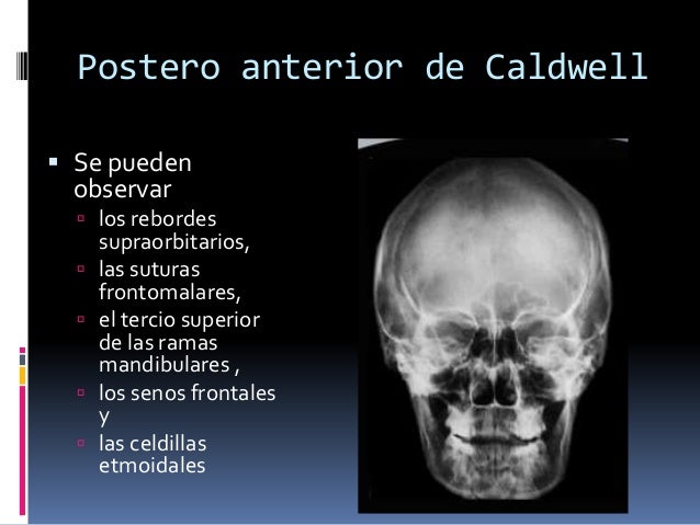 Radiologiaextrabucal