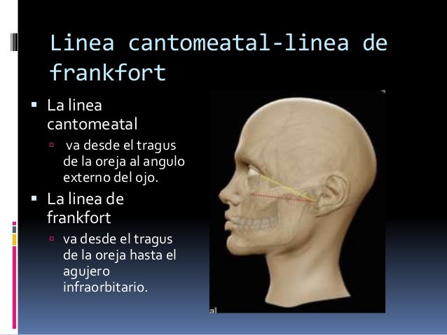 Radiologiaextrabucal