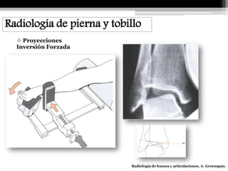 Radiologia pierna y tobillo | PDF