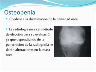 Radiologia en reumatologia | PPT