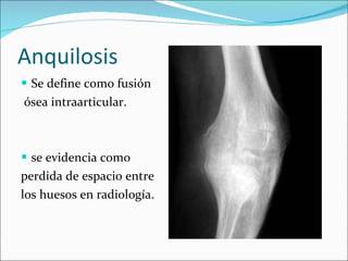 Radiologia en reumatologia | PPT