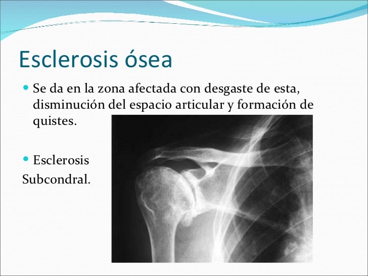 Radiologia en reumatologia