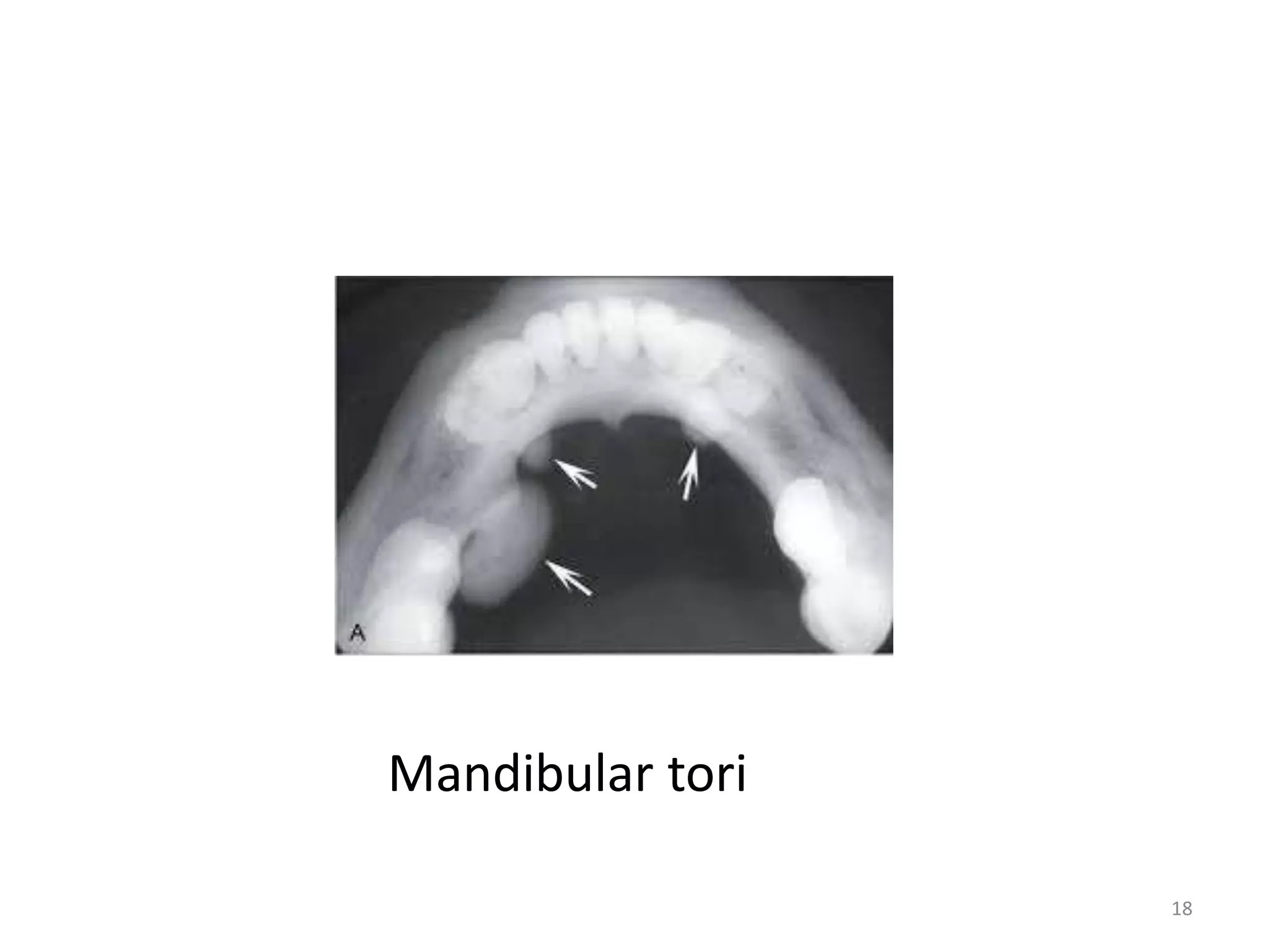 Radiology in oral & maxillofacial surgery | PPTX