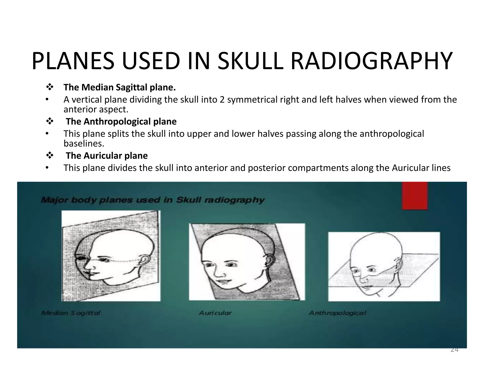 Radiology in oral & maxillofacial surgery | PPTX