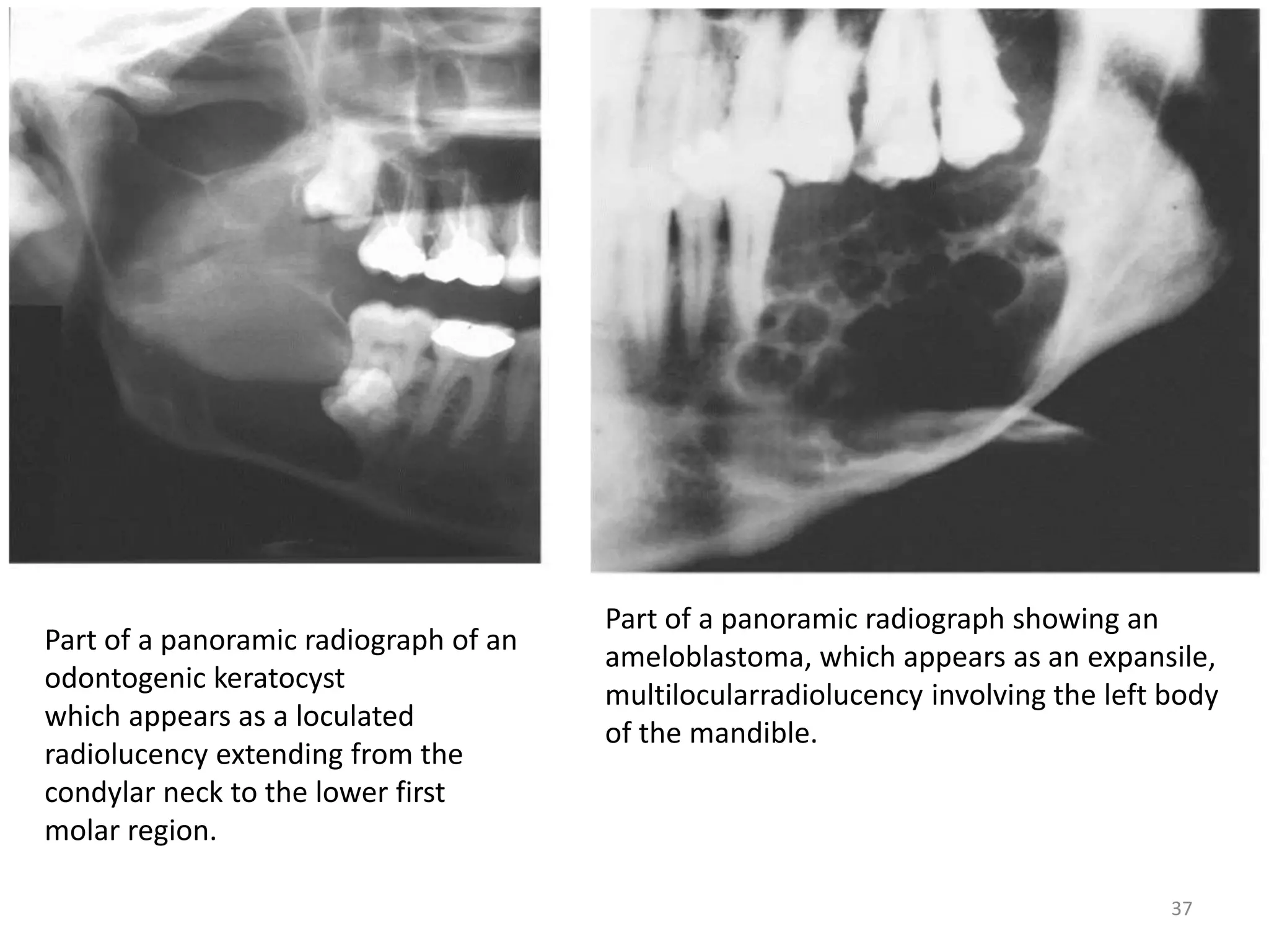 Radiology in oral & maxillofacial surgery | PPTX