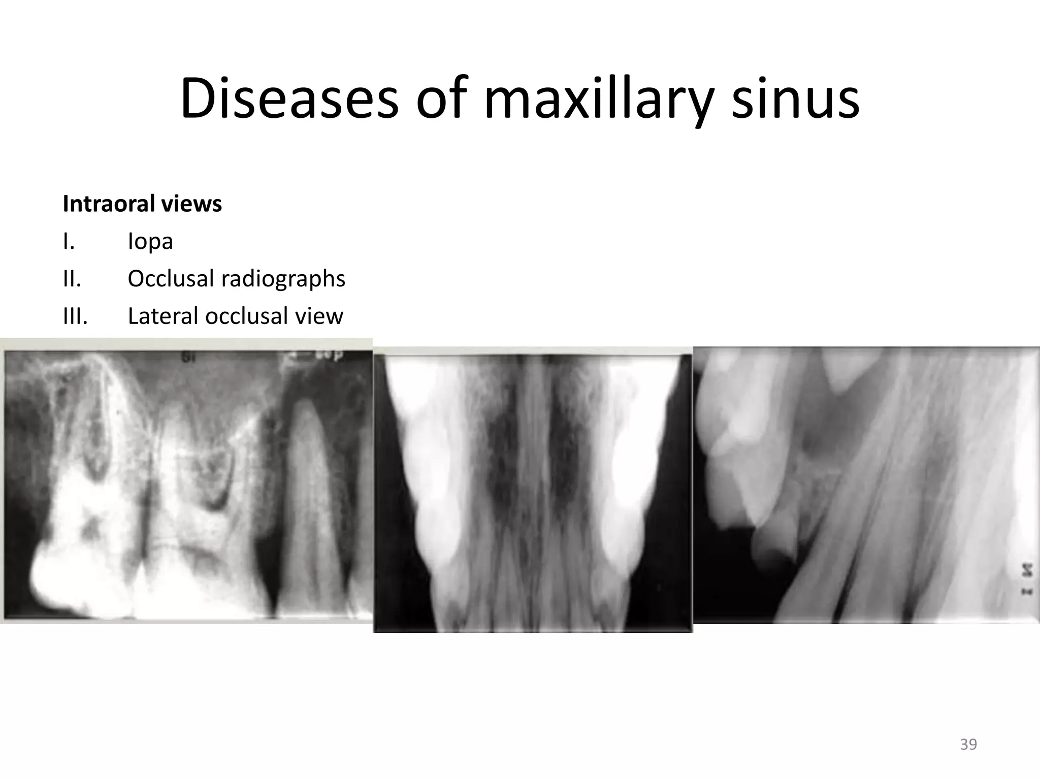 Radiology in oral & maxillofacial surgery | PPTX