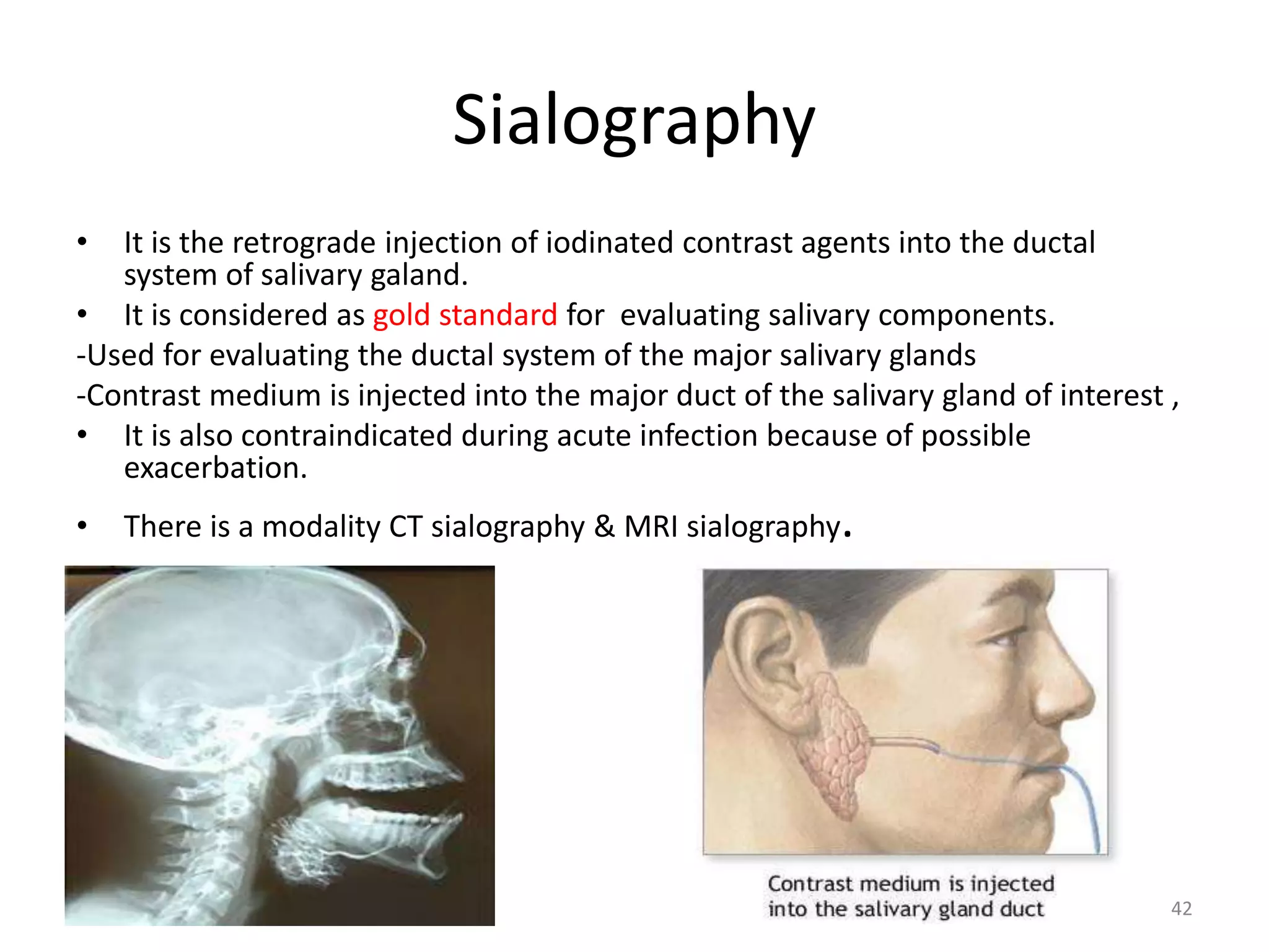 Radiology in oral & maxillofacial surgery | PPTX