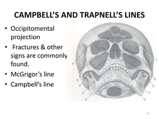 Radiology in oral & maxillofacial surgery | PPTX