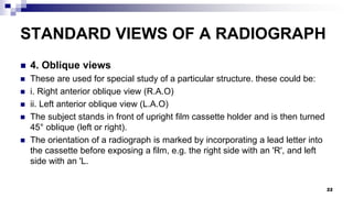 Radiological anatomy | PPT