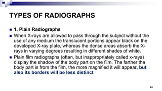 Radiological anatomy | PPT