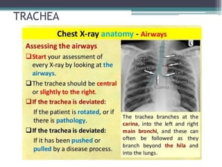 RADIOLOGICAL ANATOMY AND PATHOLOGY OF THORAX.pdf