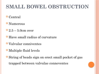 Radiological Anatomy for bone fracture.pptx