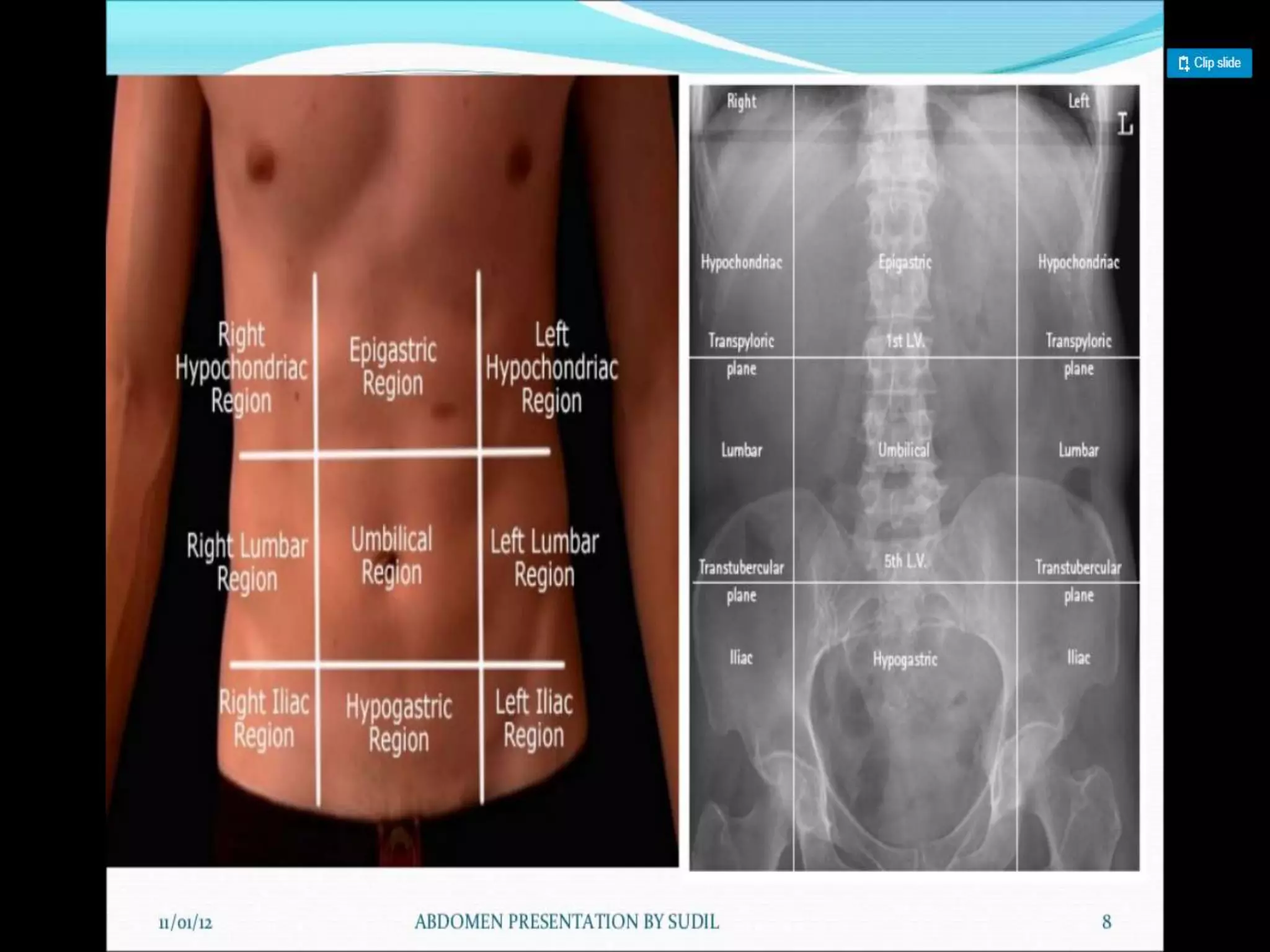 Radiological anatomy of abdomen | PPTX