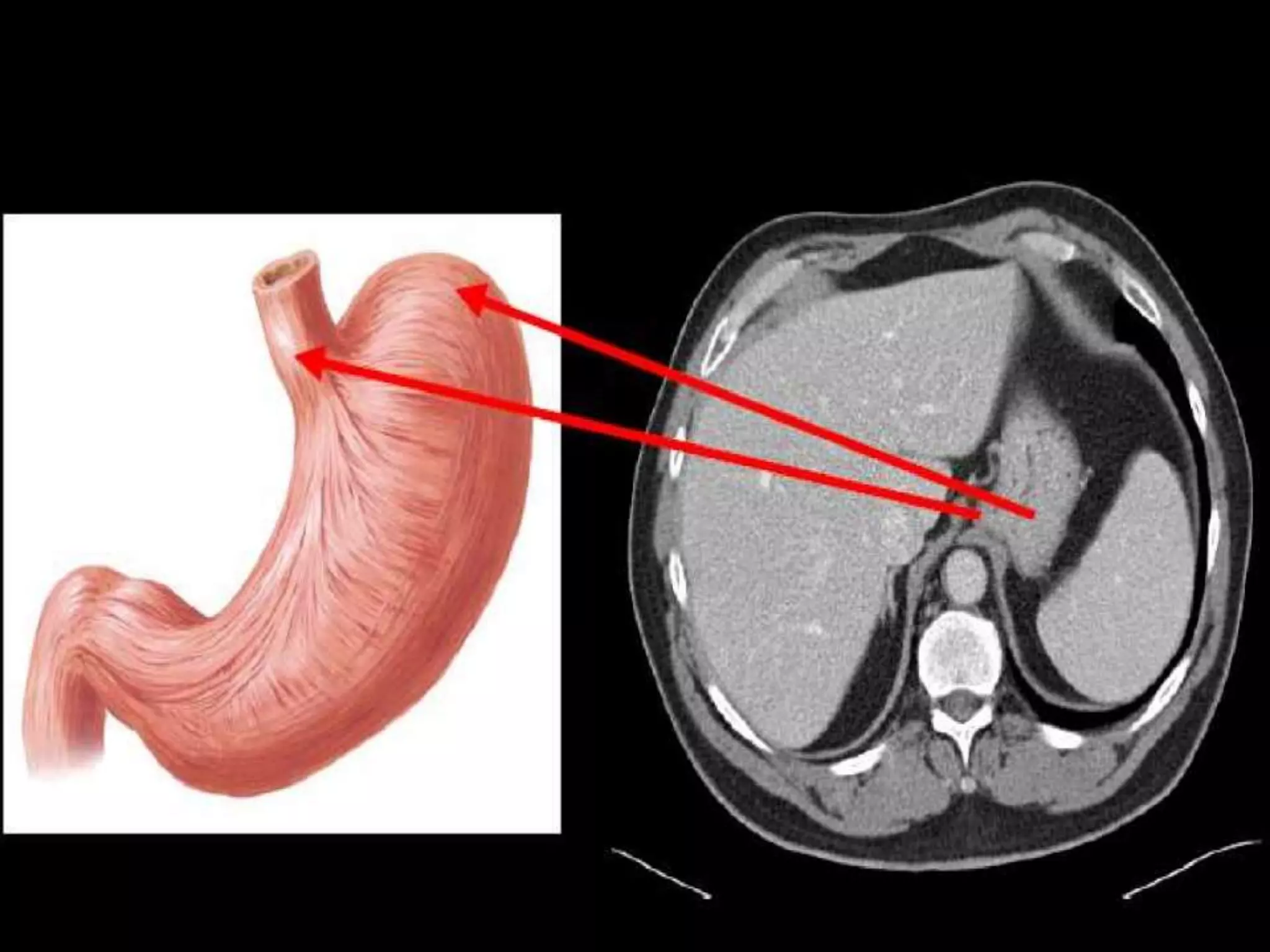 Radiological anatomy of abdomen | PPTX