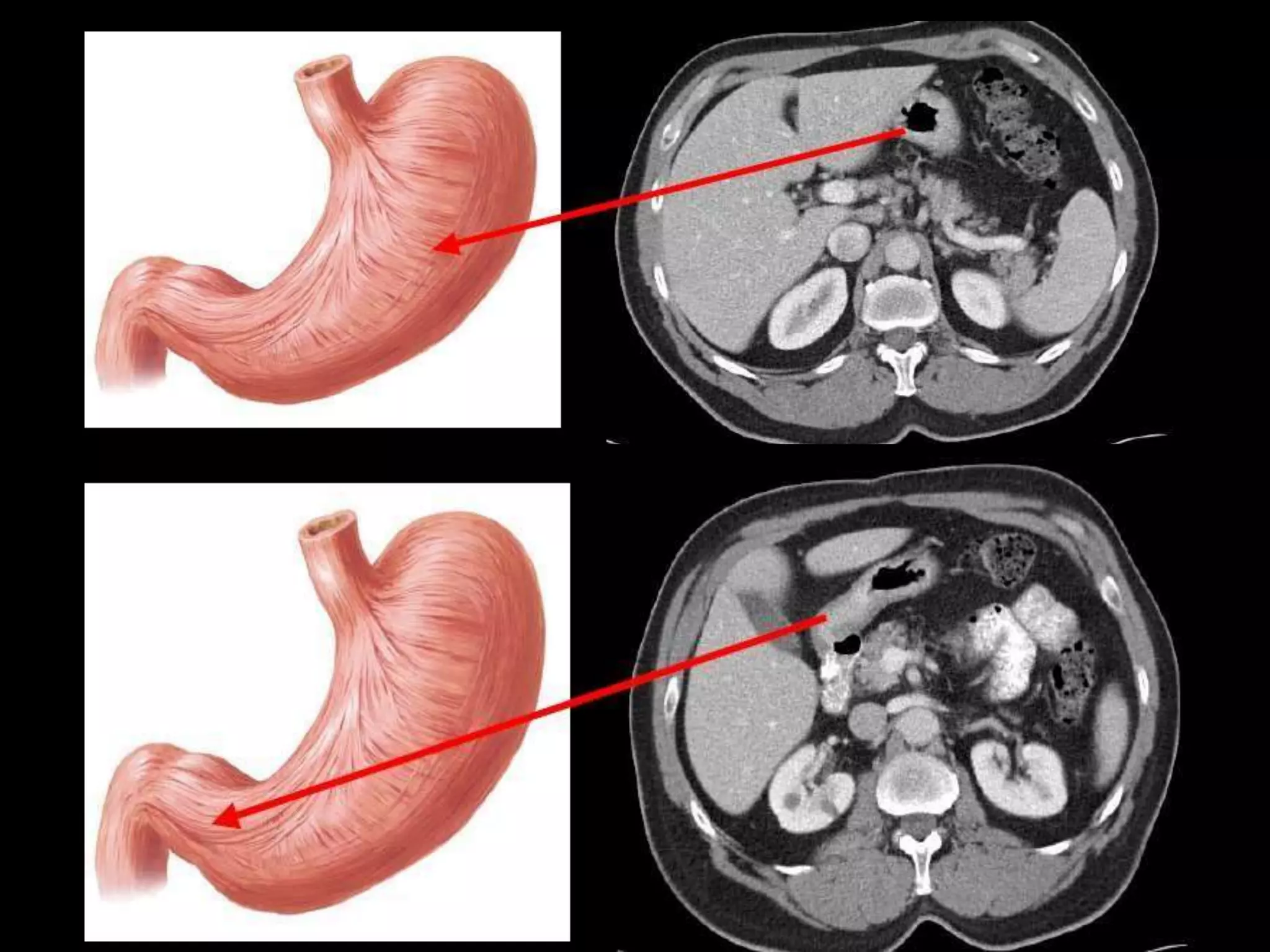 Radiological anatomy of abdomen | PPT
