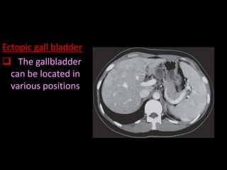 Radiological anatomy of_abdomen[1] | PPTX