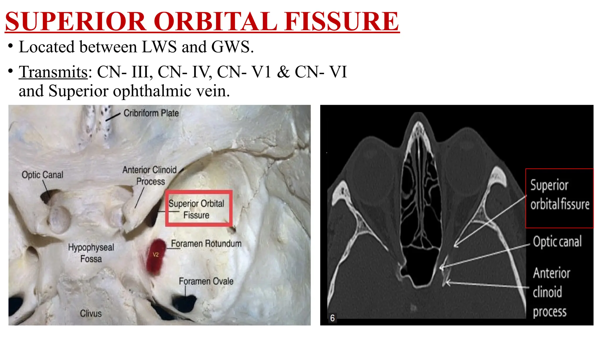 Radiological anatomy of base of the skull and craniovertevral junction ...