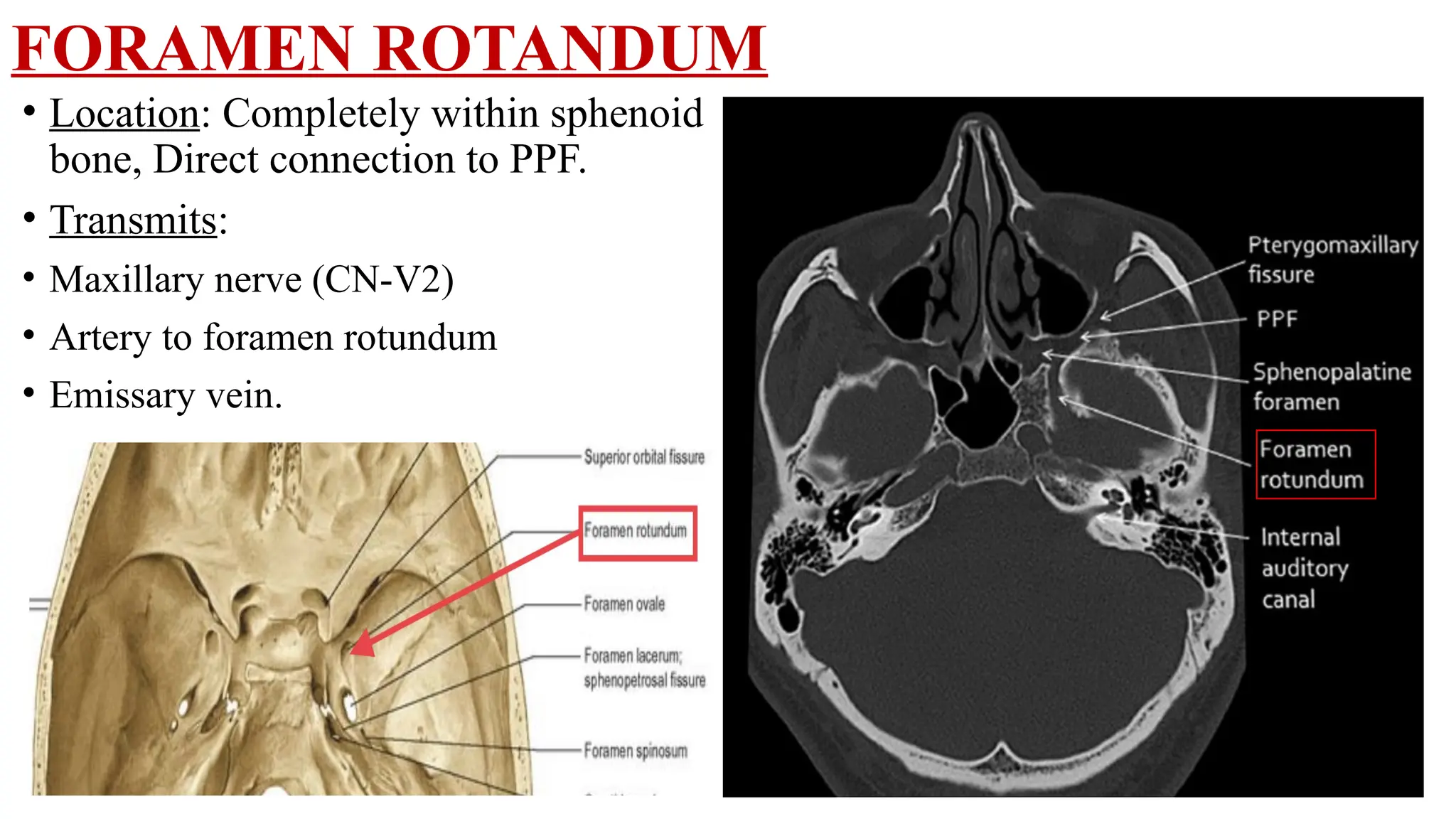 Radiological anatomy of base of the skull and craniovertevral junction ...