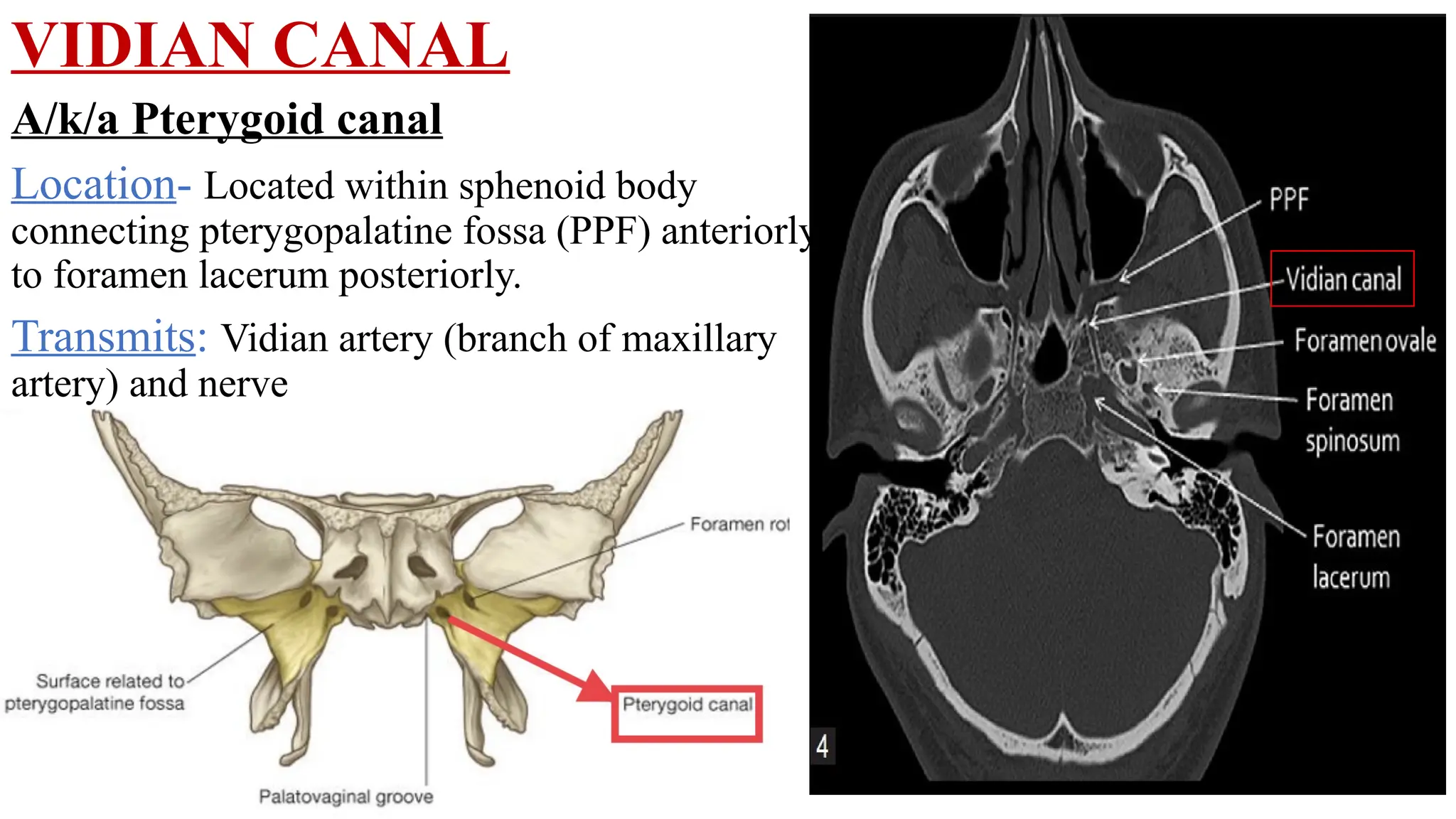 Radiological anatomy of base of the skull and craniovertevral junction ...