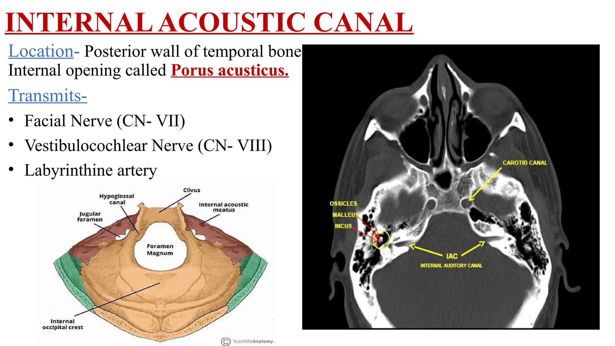Radiological anatomy of base of the skull and craniovertevral junction ...
