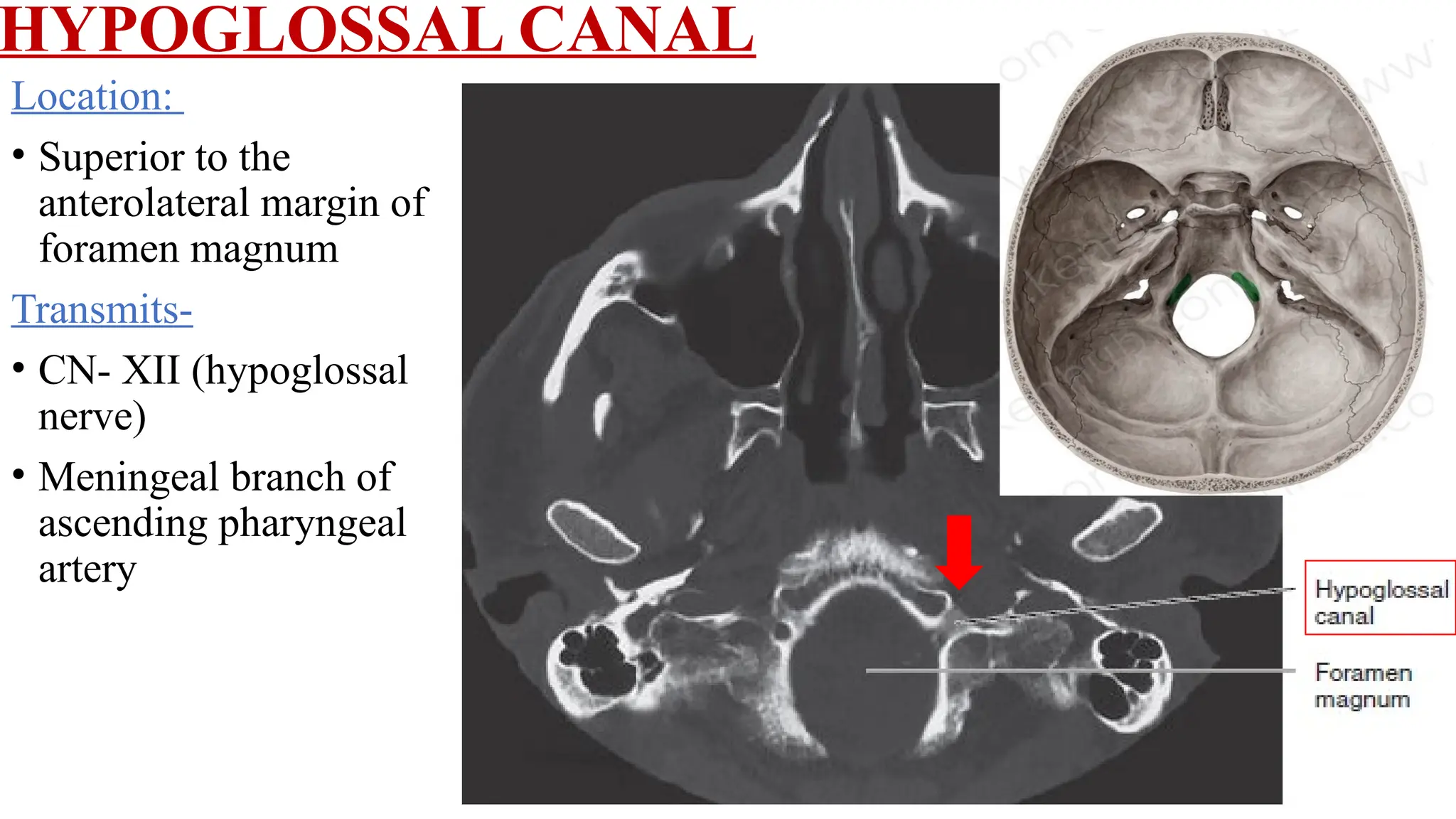 Radiological anatomy of base of the skull and craniovertevral junction ...