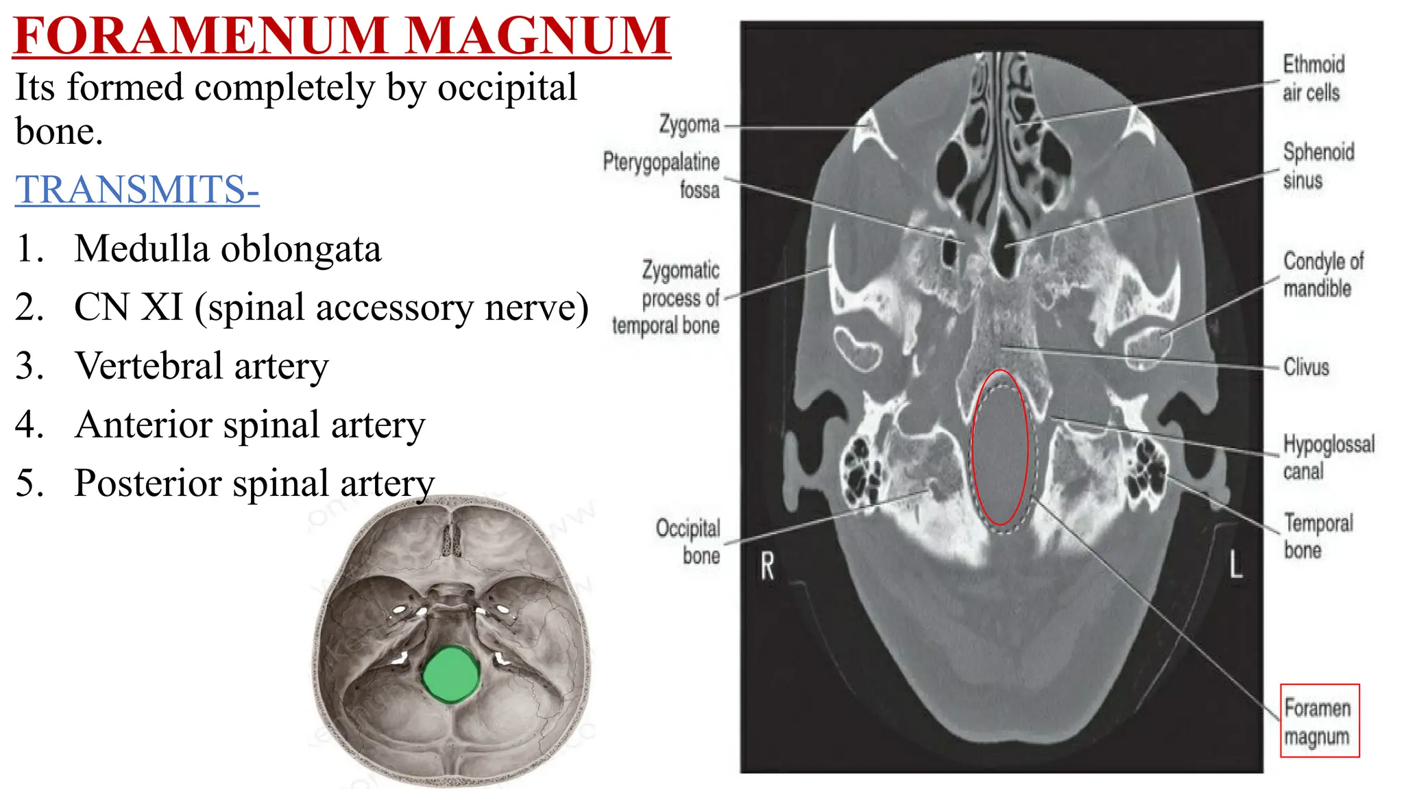 Radiological anatomy of base of the skull and craniovertevral junction ...