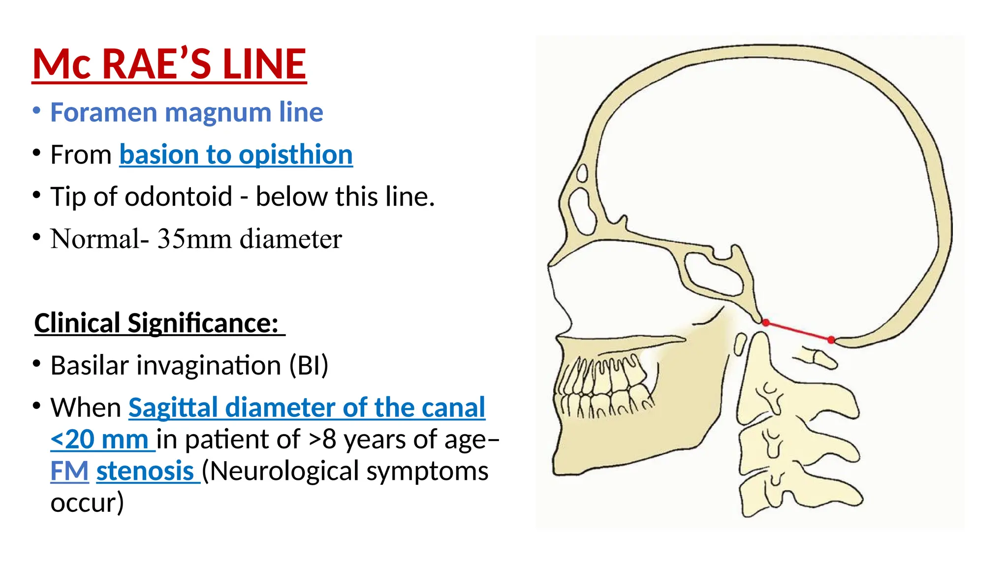 Radiological anatomy of base of the skull and craniovertevral junction ...