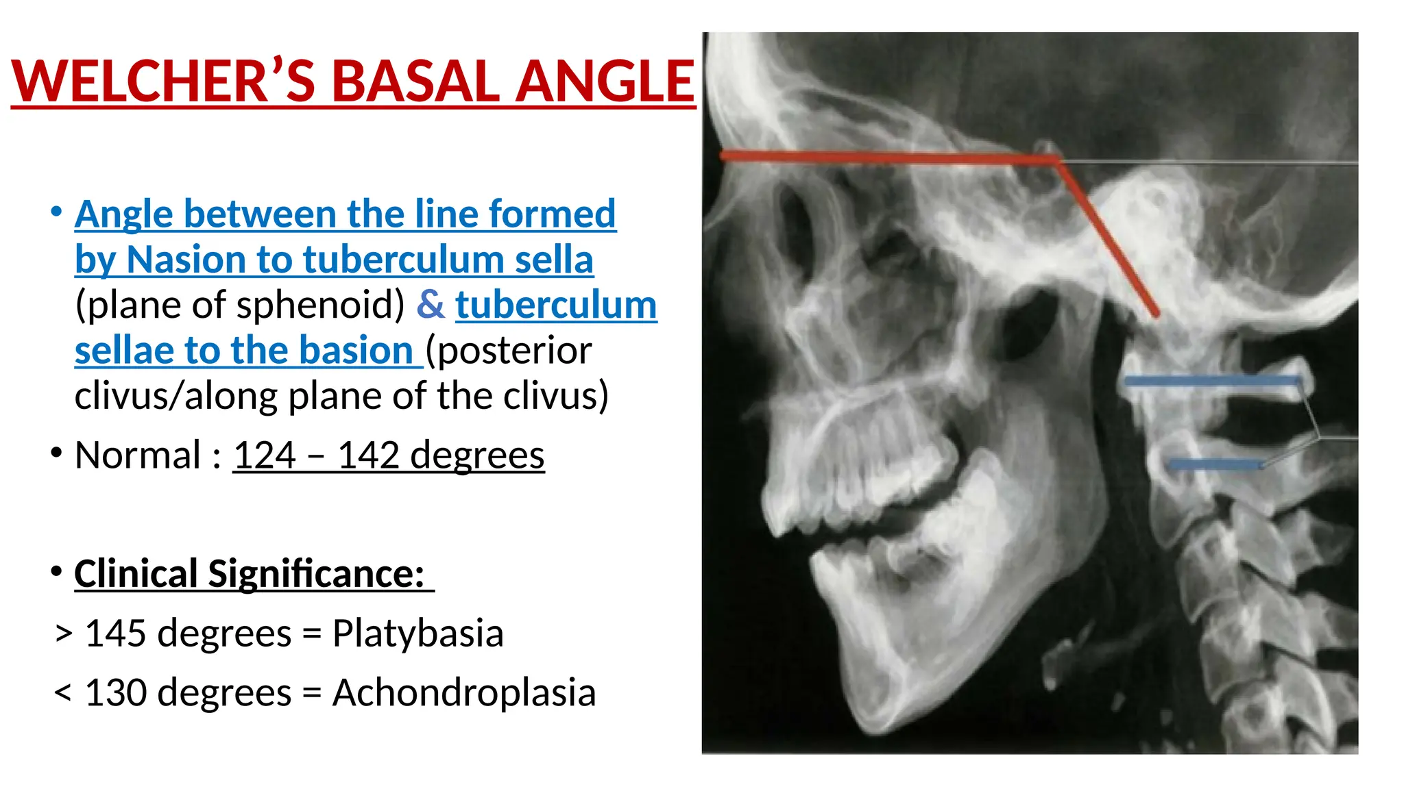 Radiological anatomy of base of the skull and craniovertevral junction ...