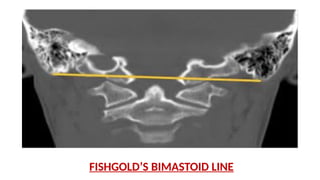 Radiological anatomy of base of the skull and craniovertevral junction ...