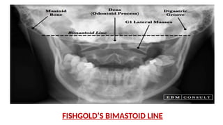 Radiological anatomy of base of the skull and craniovertevral junction ...