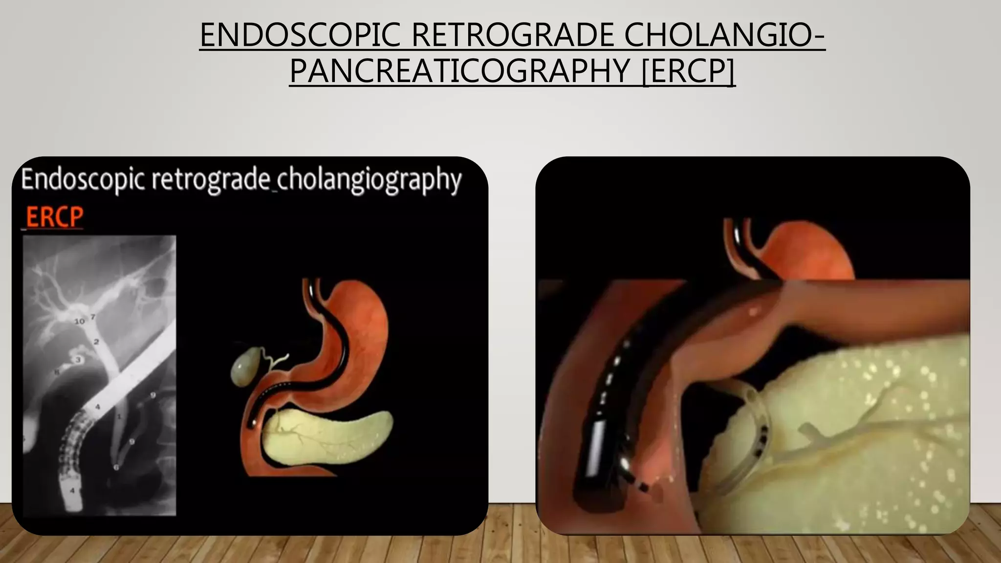 Radiological anatomy of biliary system | PPTX
