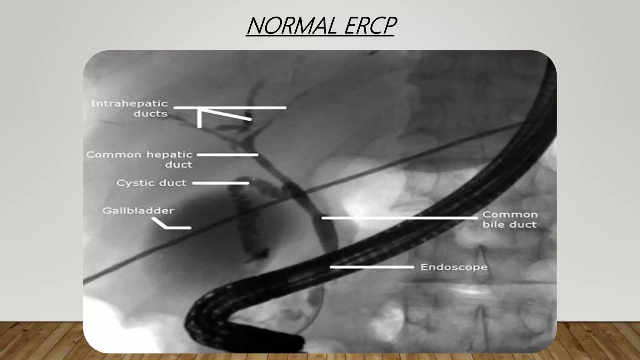 Radiological anatomy of biliary system | PPTX