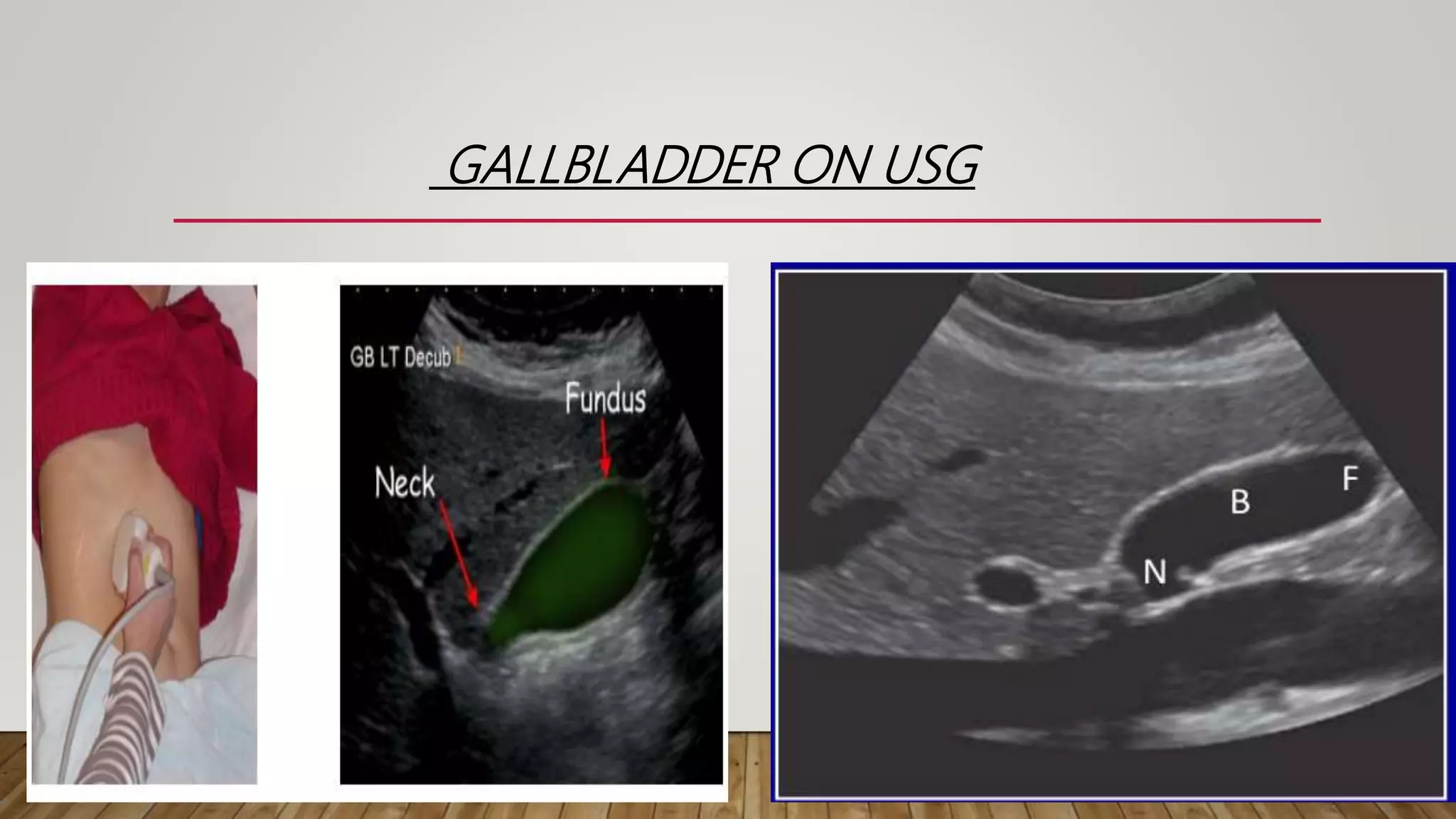 Radiological anatomy of biliary system | PPTX