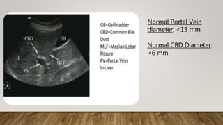 Radiological anatomy of biliary system | PPTX