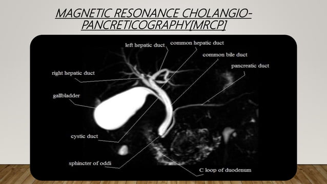 Radiological anatomy of biliary system | PPTX