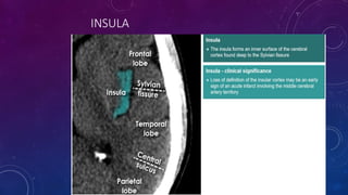 RADIOLOGICAL ANATOMY OF BRAIN.pptx………….. | PPTX