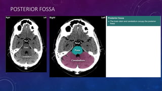 RADIOLOGICAL ANATOMY OF BRAIN.pptx………….. | PPTX