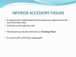 Radiological anatomy of chest including lungs,mediastinum and thoracic ...