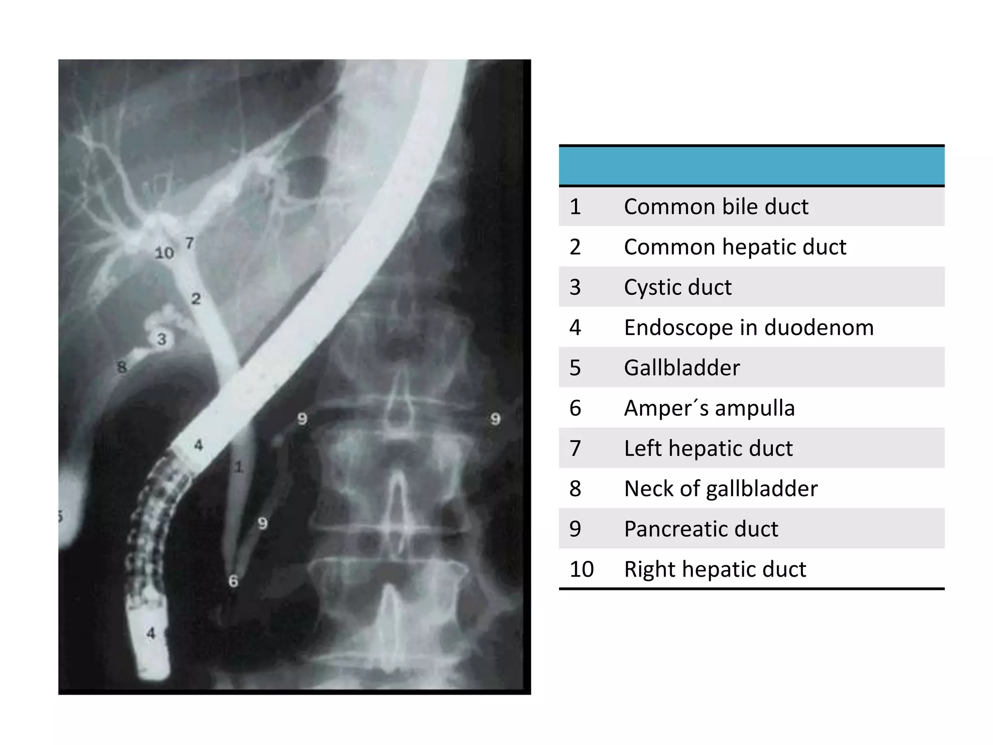 Radiological anatomy of hepatobiliary system | PPTX