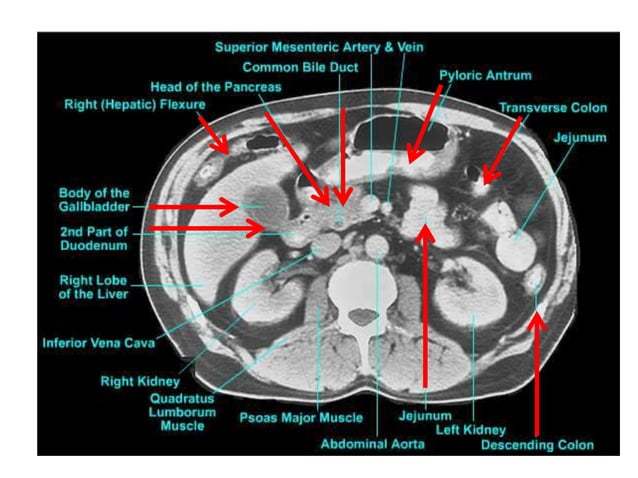 Radiological anatomy of hepatobiliary system